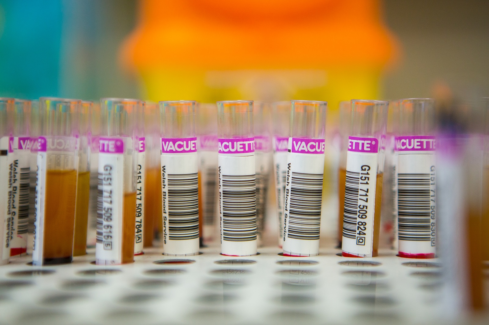 How do we test your blood donation? - Welsh Blood Service